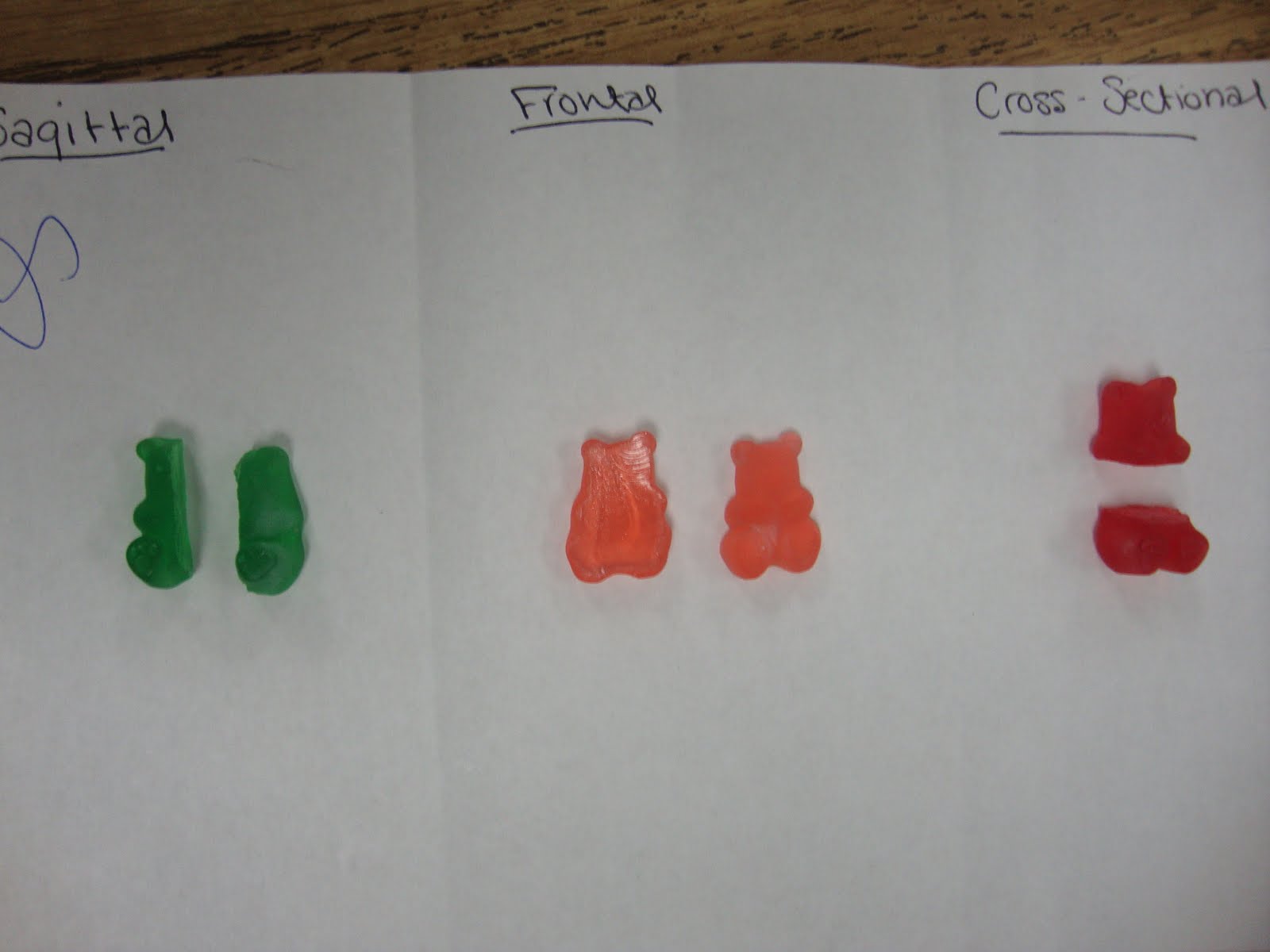 Anatomy&Physiology212: Body Planes and Sections