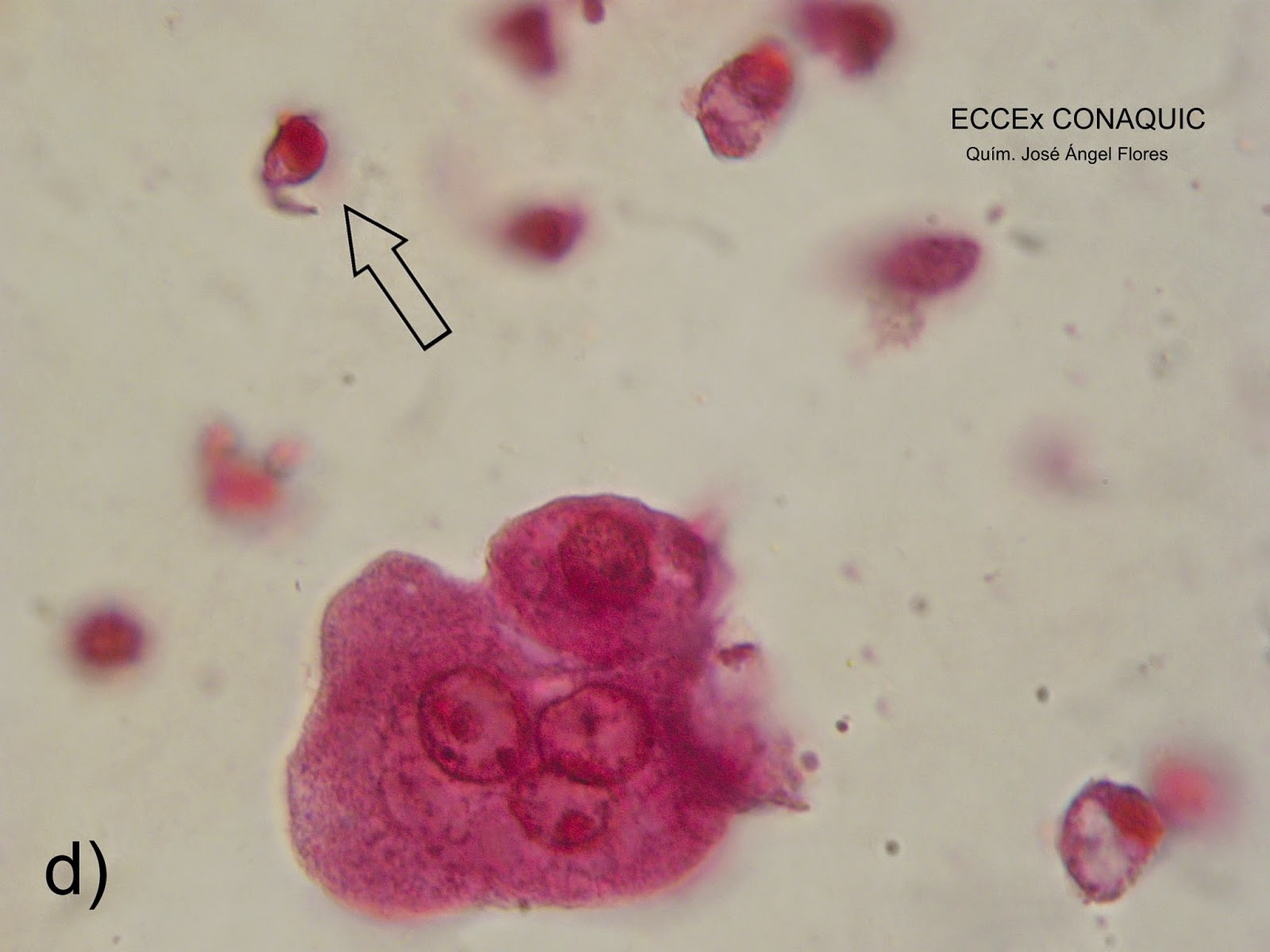 Examen General de Orina: 2014