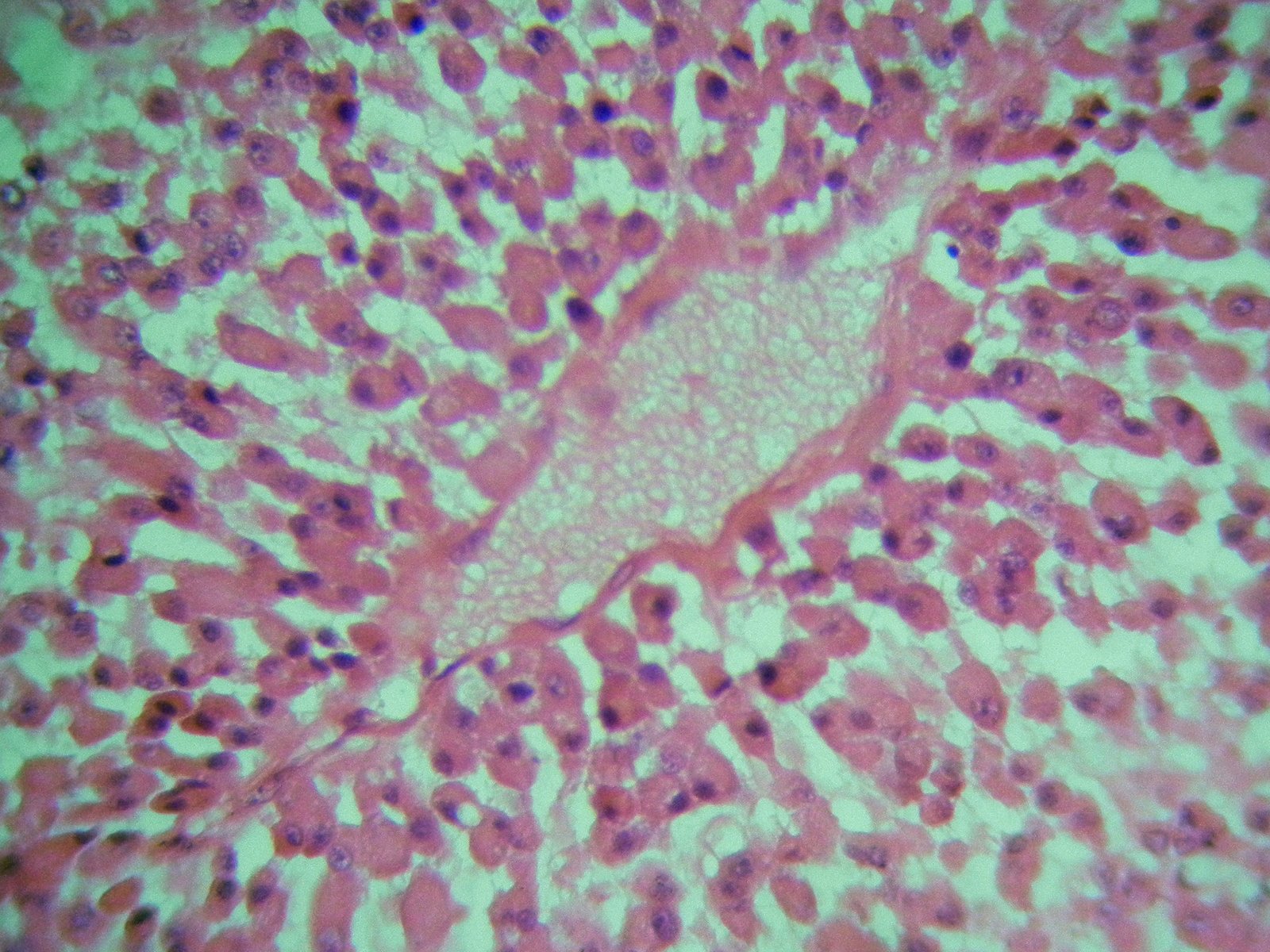 into the roots: Testis