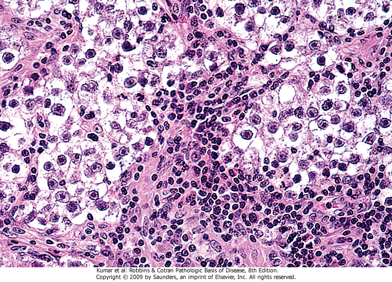 Patología 2013: AP. GENITAL FEMENINO