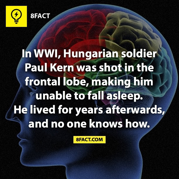 In WWI,Hungarian soldier Paul Kern was shot in the frontal lobe, making ...