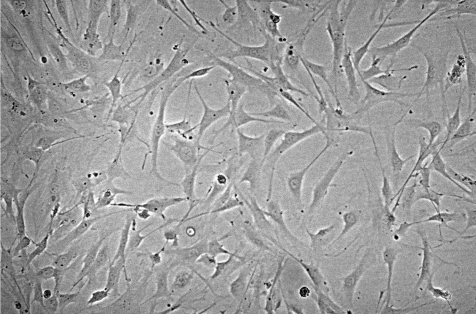 Neuromics: New Human RPES and BMSCS