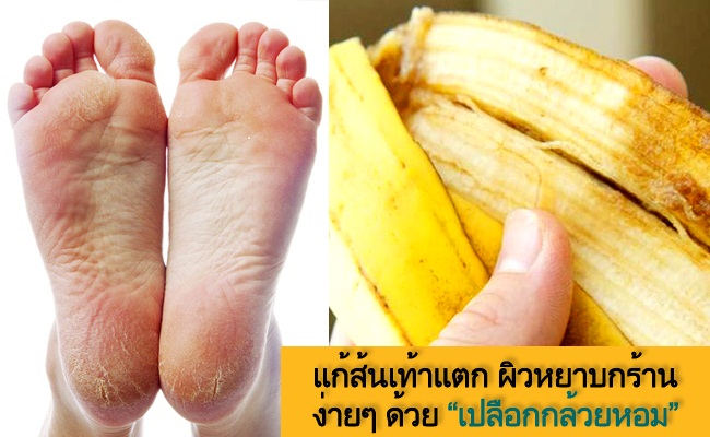 Do You Know The Benefits Of Banana Feet?