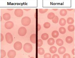 Blog Juruteknologi Makmal Perubatan @ MAD LAB BLOG: SMEAR SEL DARAH NORMAL