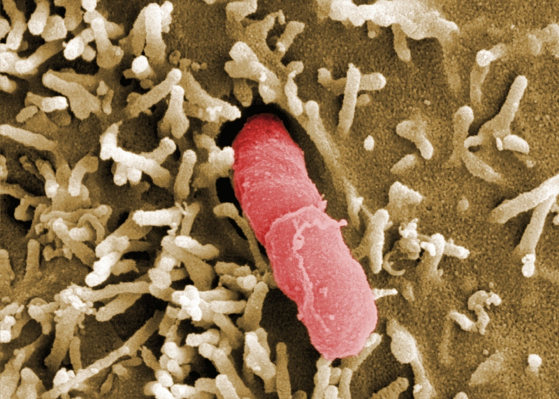 Yersinia pseudotuberculosis - Alchetron, the free social encyclopedia