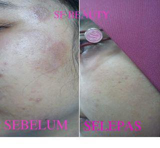 SF Beauty 'a proven skincare products'