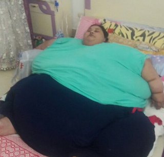 ‘Living bombshell’: World’s heaviest woman flies to India to fight for ...