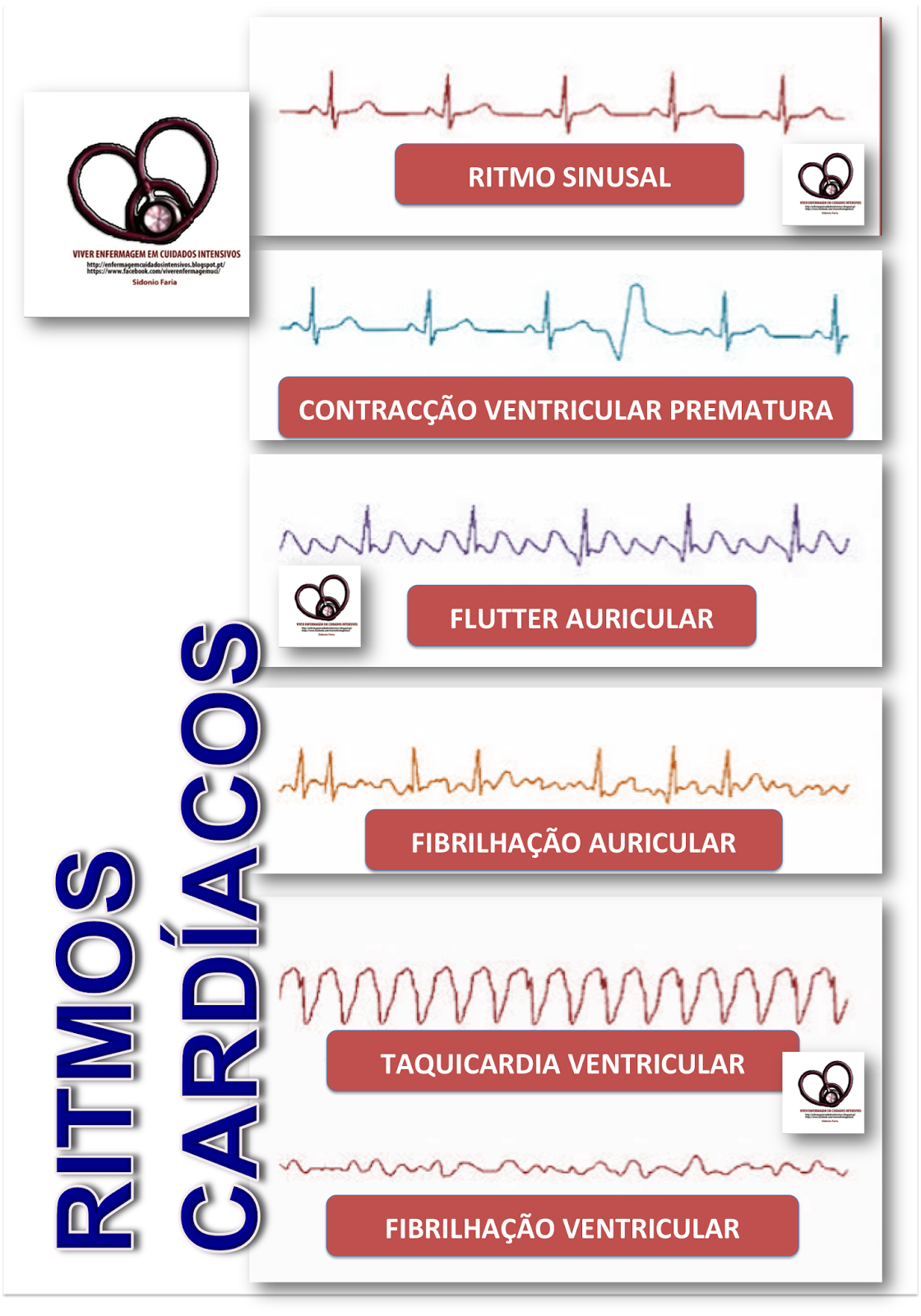 Ritmos Cardíacos Chocáveis E Não Chocáveis - RETOEDU