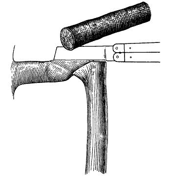 MAMAY P's Pinoy Halu-Halo: TULI (Circumcision)