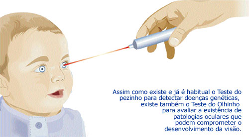 Mães & Babies: Teste do Olhinho ou Reflexo vermelho