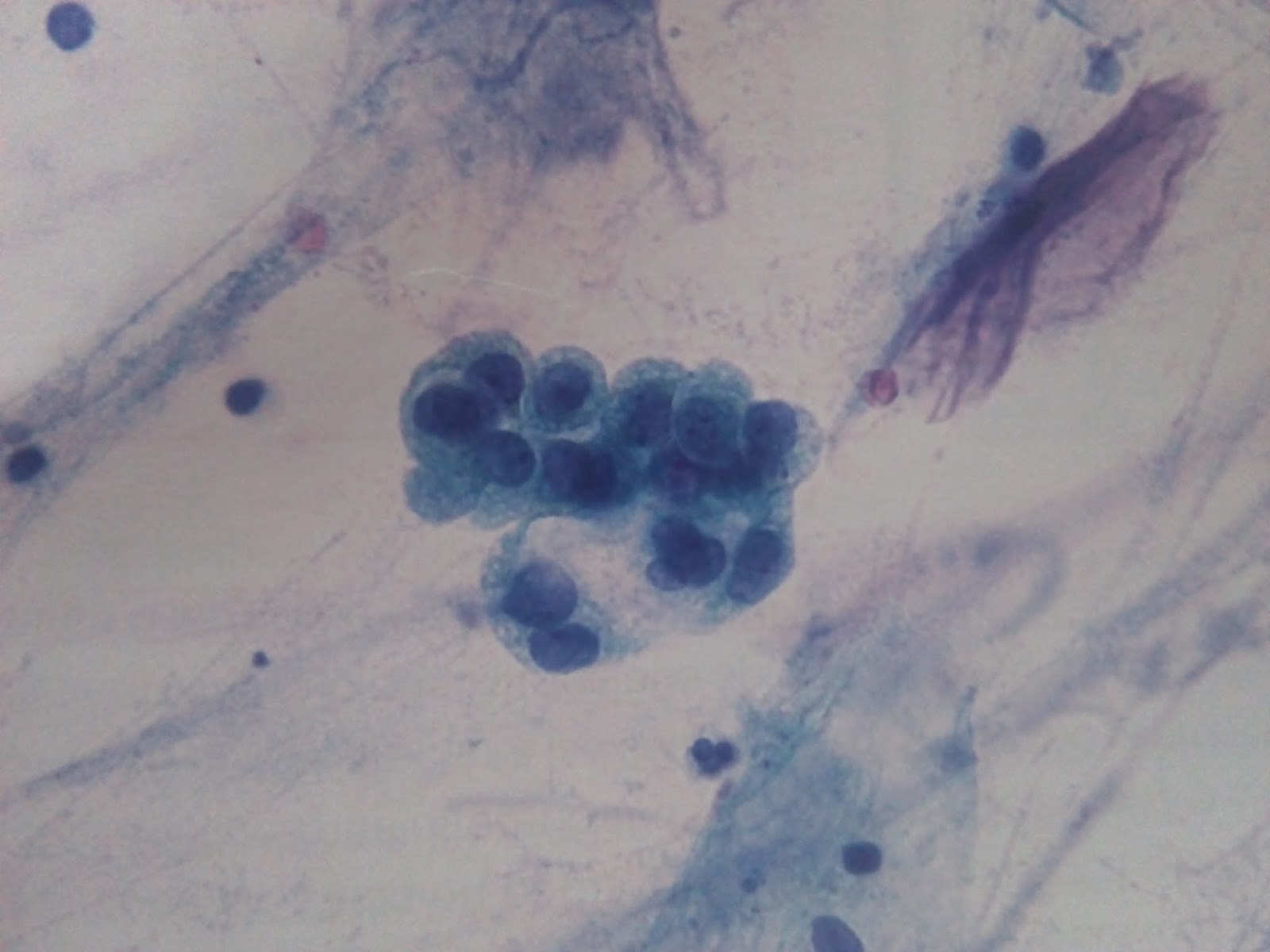 Anatomia patológica: Tema 1 . Histologia del aparato respiratorio