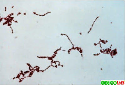 [Microbiology] Atlas of Anaerobes of Clinical Importance | Free Medical ...