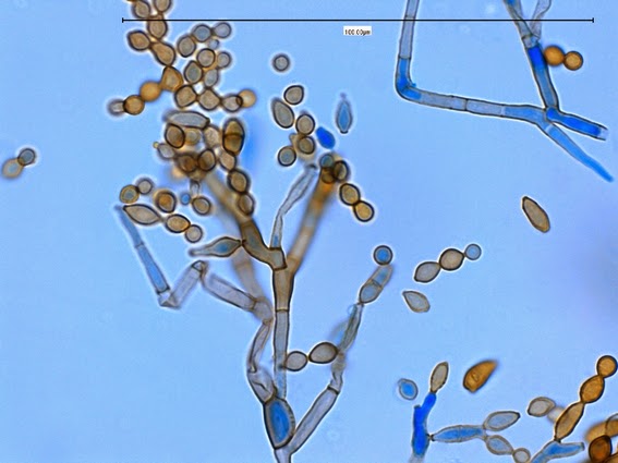 Fun With Microbiology (What's Buggin' You?): June 2014