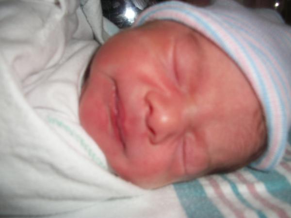 Roxy's Journey with 1q21.1 microduplication Syndrome : Meet Roxanne ...