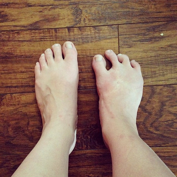 Life On Our Terms: May 2014