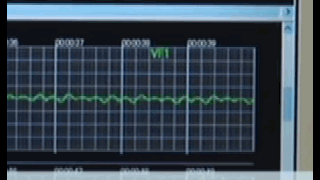 Medical Devices Sanity: NIHON KOHDEN CardioLife Acti-Biphasic ...