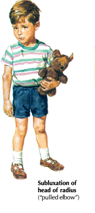 Orthopaedics and Sports Medicine: Children - The Pulled Elbow.