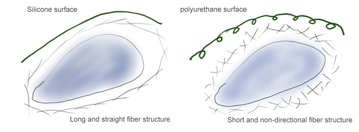 Dr. Lee Breast augmentation Korea: Breast augmentation Korea - micro ...