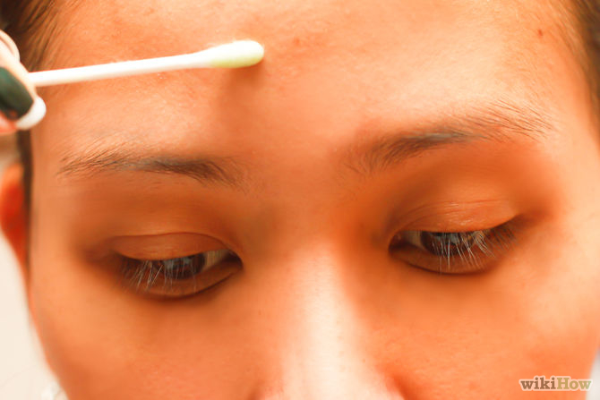 How to Get Rid of Subclinical Acne on Forehead