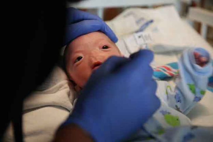 See Now: This Baby Was Born Without Nose, So Cute! ~ Entertainment News ...