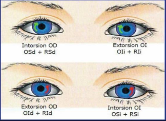 Cátedra N° 21 - Seminario N° 11 "Test de Parks"