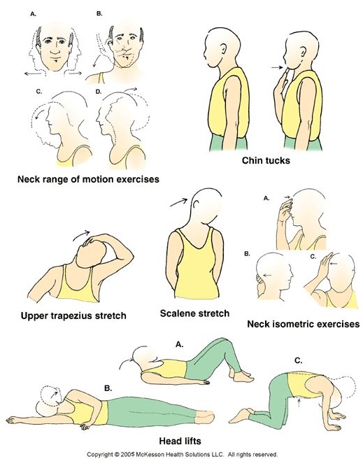 Back to Basics to Prevent Back Pain