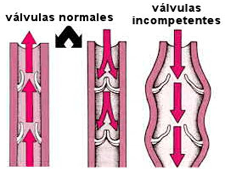 EL PORTAL MÉDICO : junio 2013