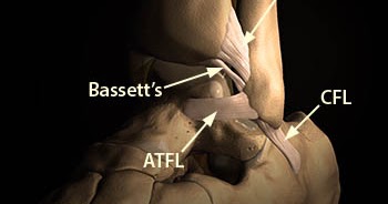 MRI Musculo-Skeletal Section: Accessory anterior inferior tibio-fibular ...