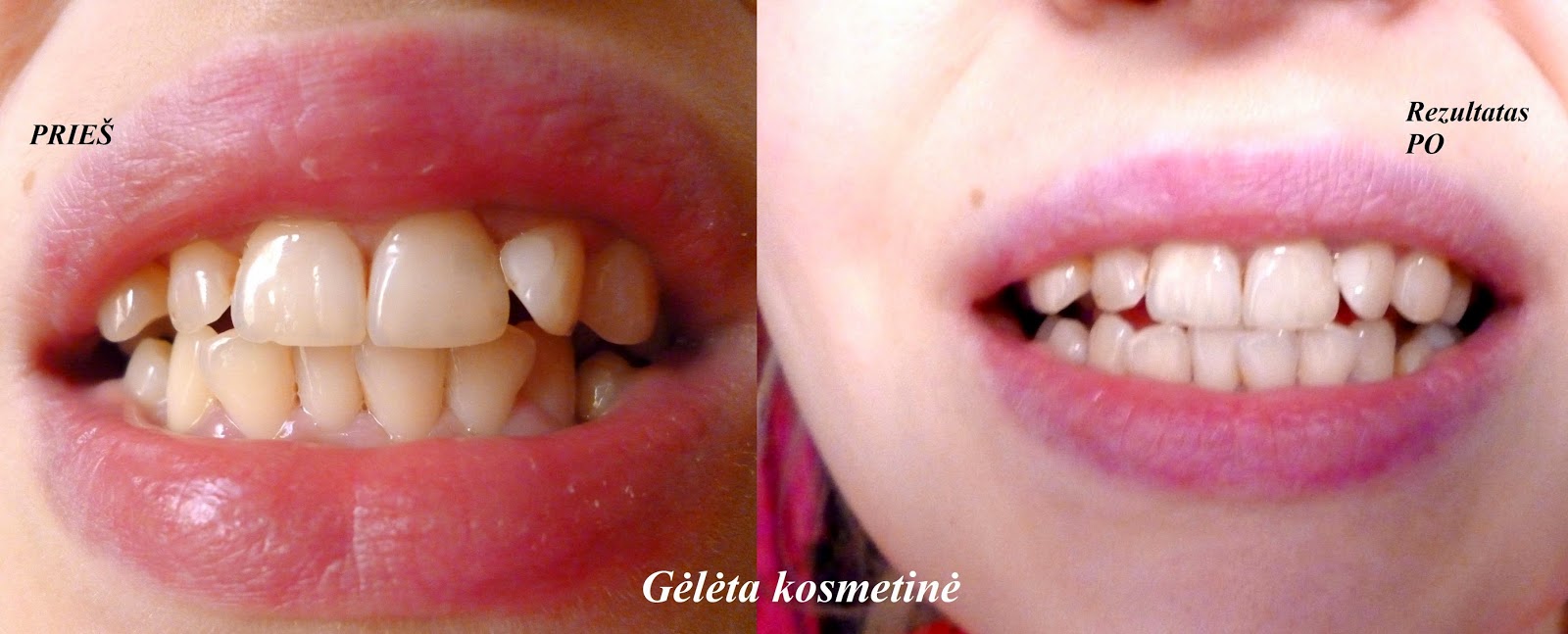 Mėnesio eksperimentas #4: baltesni dantys. Velym ir Velym Mineral.