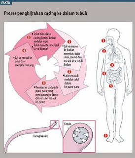Colorful Wonderful Beautiful: Cacing dalam perut