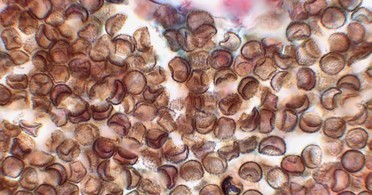 Corn Smut Microscope