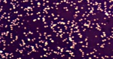 Negative Staining and Hanging Drop Procedure | Learn Microbiology