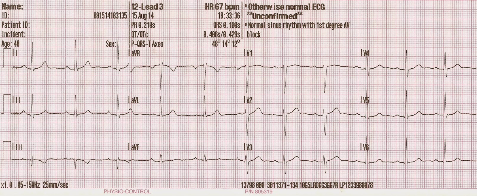 Prehospital Wisdom: 12-Lead Layout