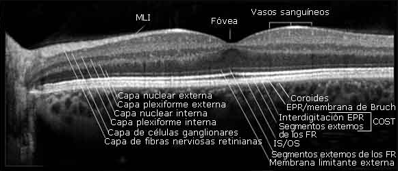Cátedra N° 03 - Conceptos básicos de OCT