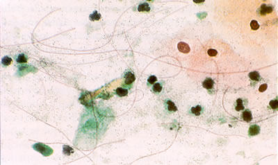 LAS BACTERIAS: octubre 2015