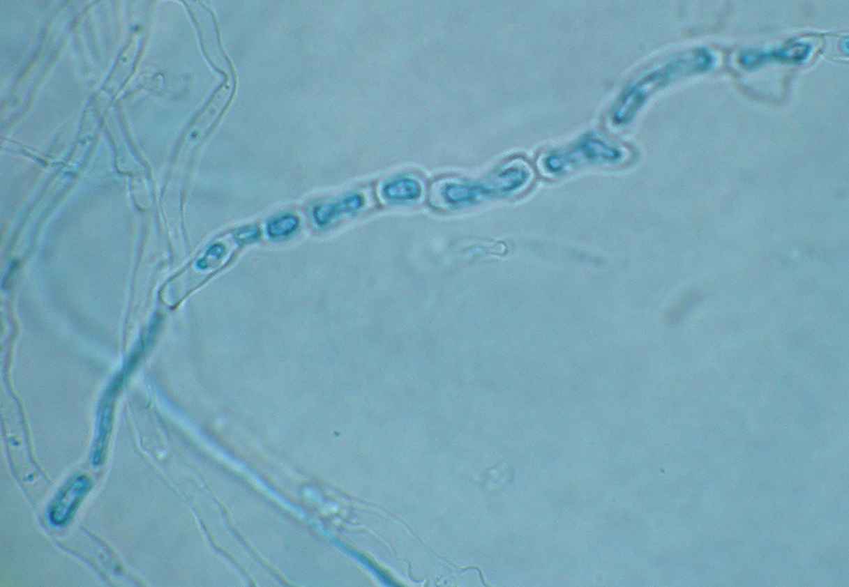 ATLAS MICOLOGIA: NEOSCYTALIDIUM HYALINUM