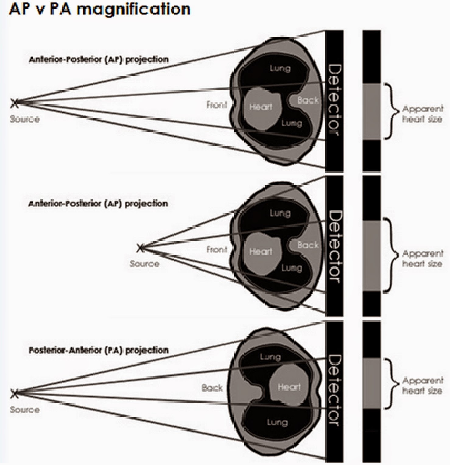 ESPE 102 2014: Magnificación