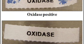 OXIDASE TEST - Microbiology Laboratory Turkey
