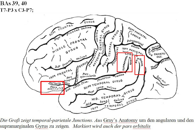 www.brainbalances.de: Parietallappen Medial Dorsaler Aspekt, wichtig ...