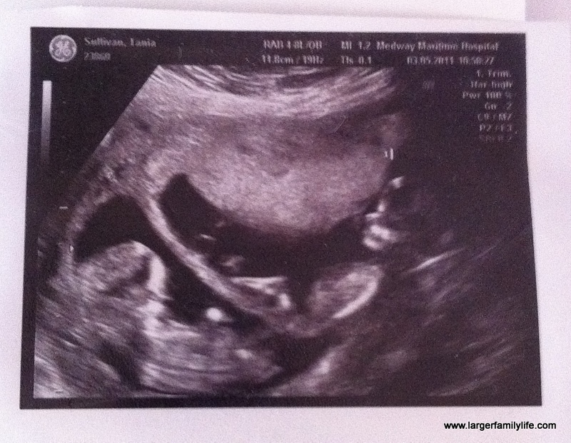 Twin Pregnancy Diary - 12 weeks 4 days | Larger Family Life