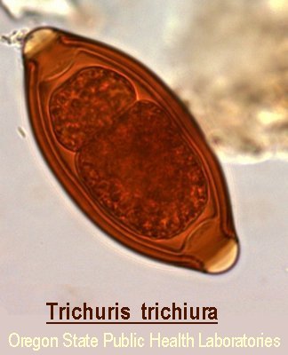 Izadora Ornelas Almeida: Trichuris Trichiura...