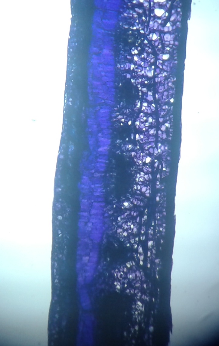 BIOLOGIA VEGETAL-UPTC-: LA HOJA