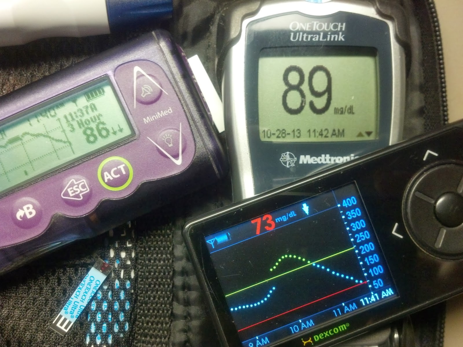 Diabetes Life Balance: First Threshold Suspend on Medtronic 530G(!!!)