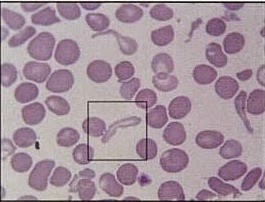 HEMATOLOGÍA