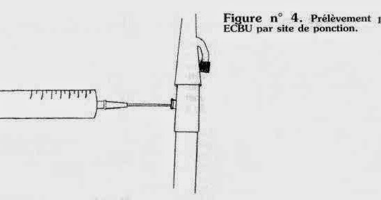 L'ECBU | Récap' IDE