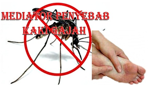 Mengenali Penyakit Kaki Gajah | Tips Pola Hidup Sehat Yang Benar