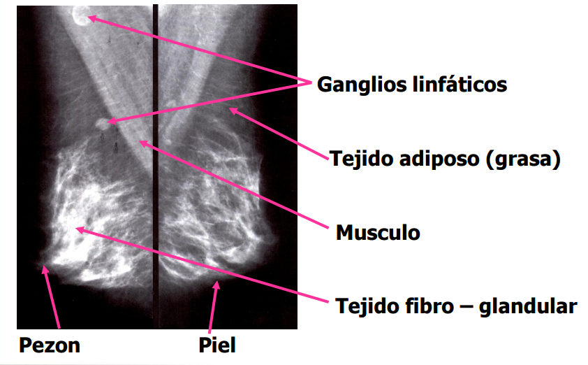 PRODUCCIÓN Y TRATAMIENTO DE IMAGENES DIAGNOSTICAS: MAMOGRAFIA- TOMOSINTESIS