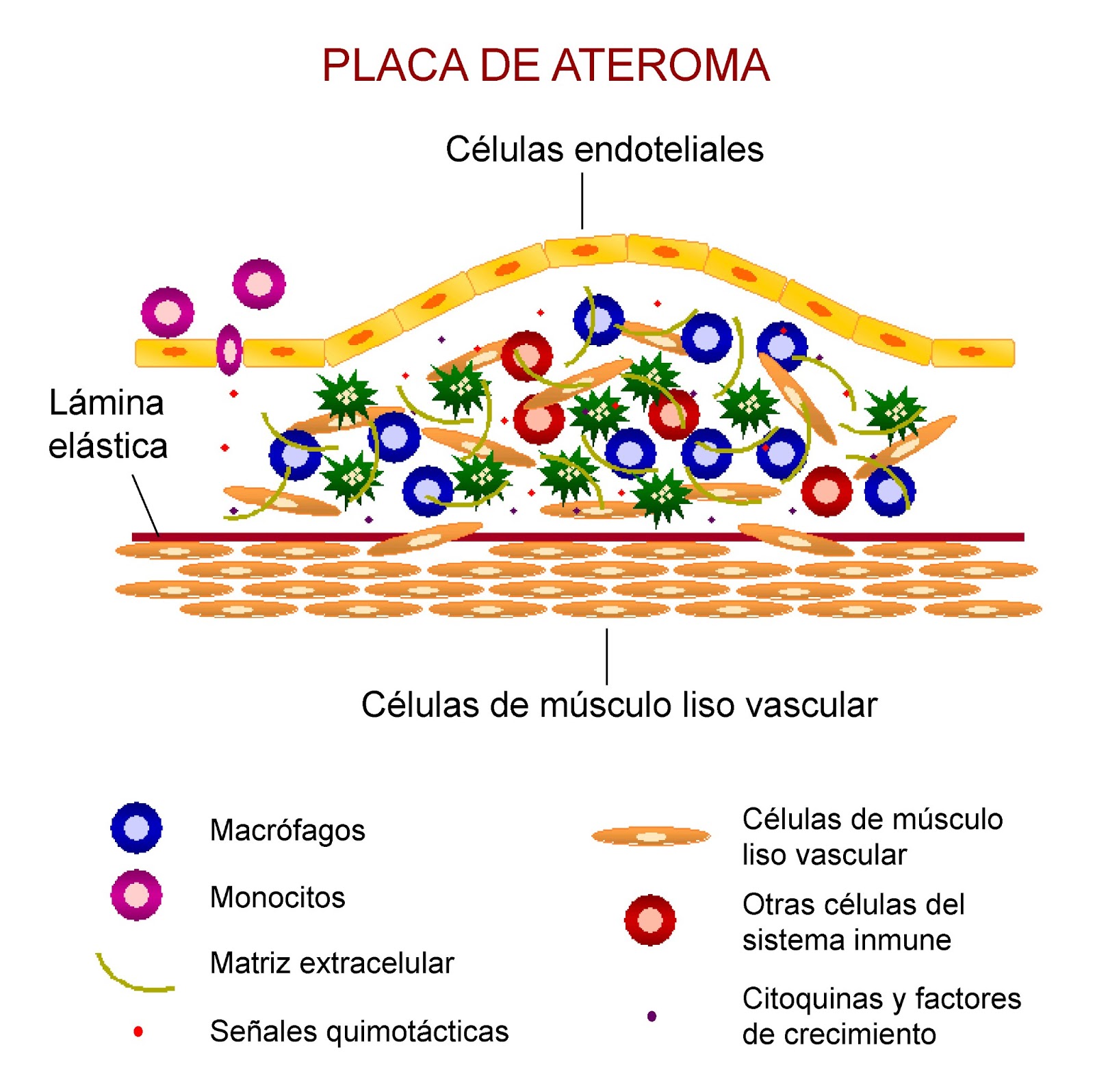 placa de ateroma - wood scribd braxin