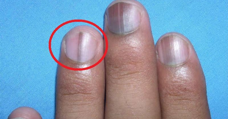 Some Signs On Nails Can Predict Your Future Astro Upay some-signs-on-nails-can-predict-your-future-astro-upay