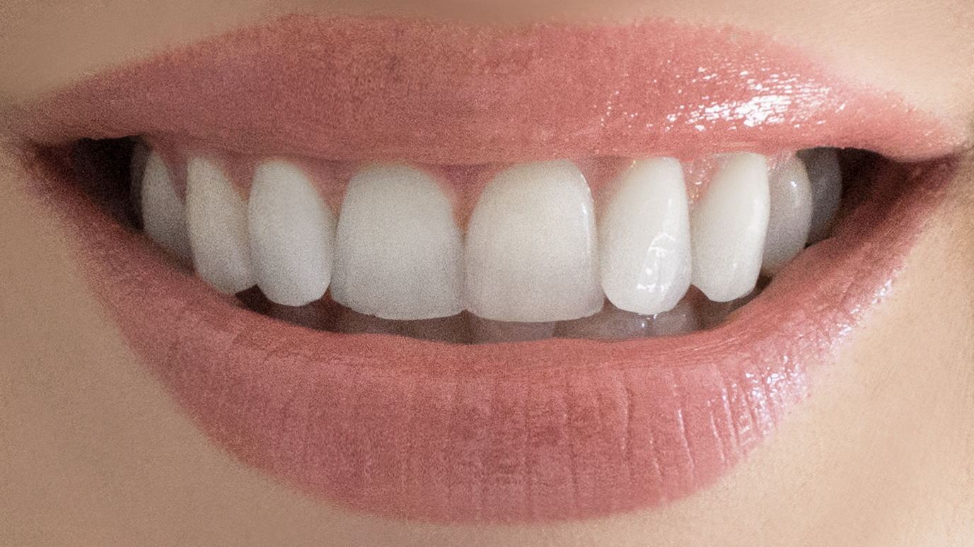 SMILE BRILLIANT REVIEW